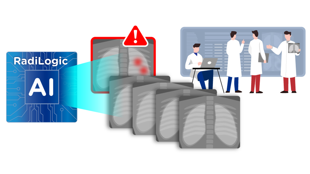 AI Tool to Enhance COVID-19 Screening