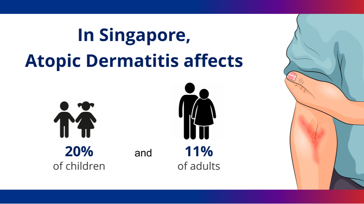 Atopic dermatitis: the search for answers