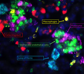 GIS RESEARCHERS DEVELOP FISHNCHIPS TO VISUALIZE DIFFERENT CELL TYPES ...